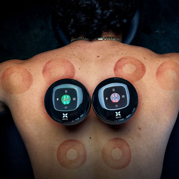REVO™ Smart Cupping Bundle – Revomadic